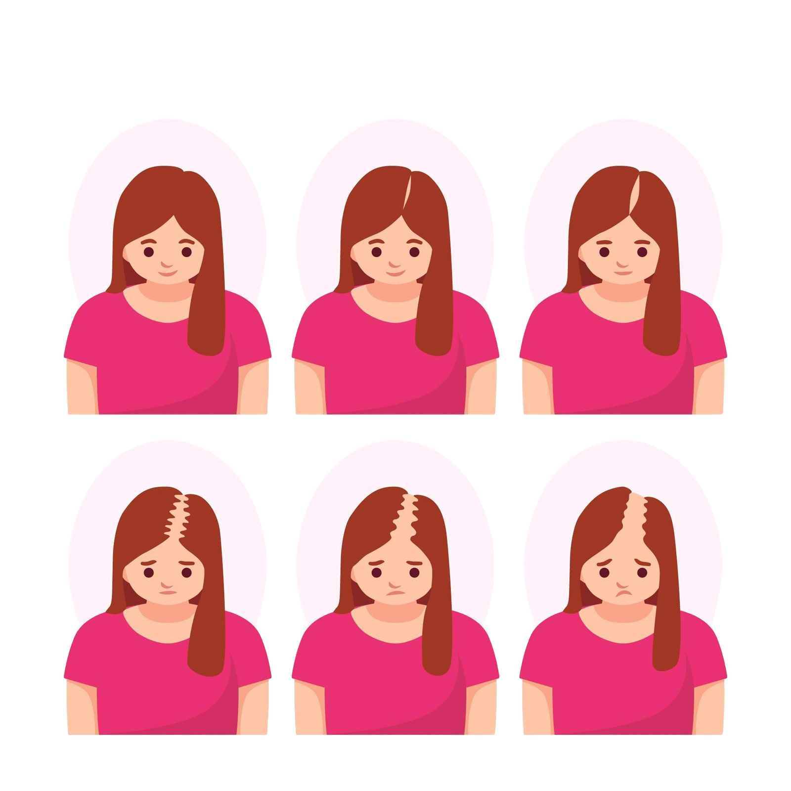 Understanding & Treating Female Pattern Baldness: Causes, Symptoms ...